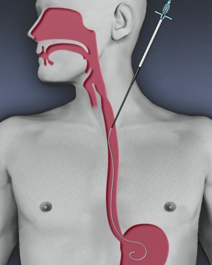 PTEG – 廿日市記念病院