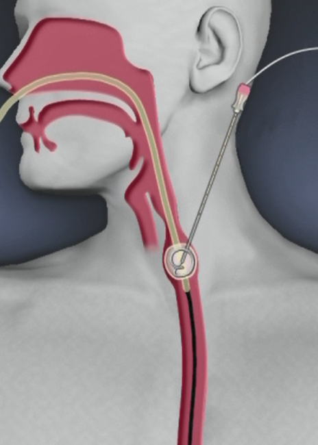 PTEG – 廿日市記念病院